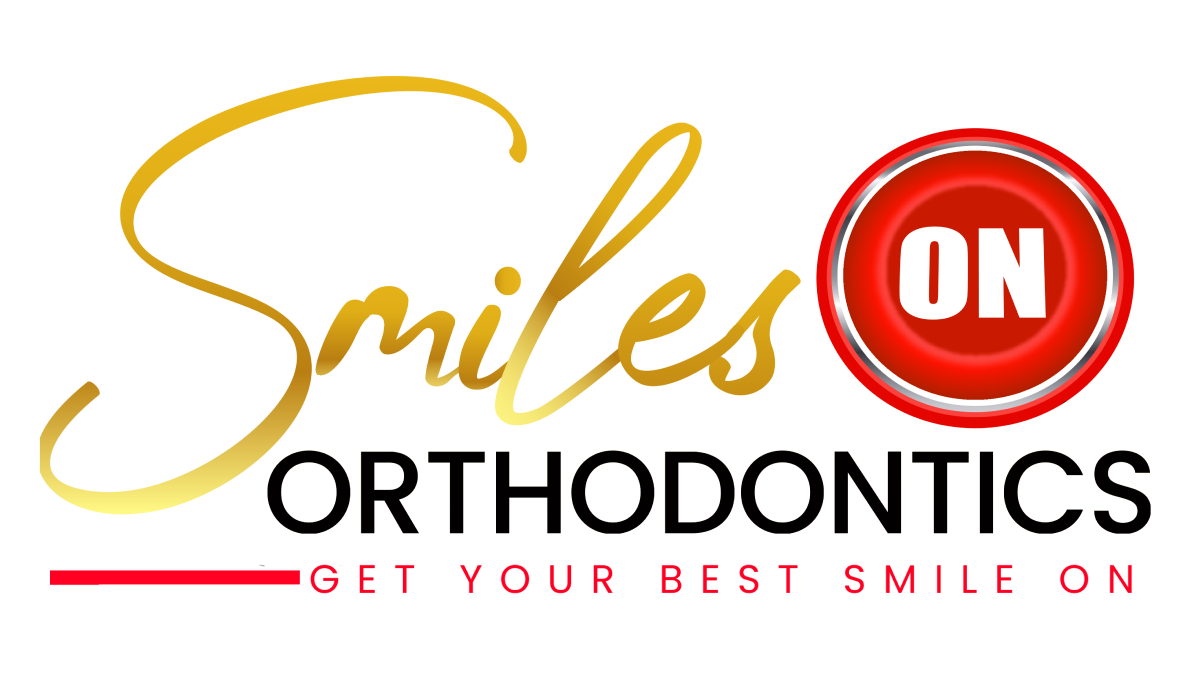 Maxillary Skeletal Expander (MSE) - Katy, TX - Smiles ON Orthodontics